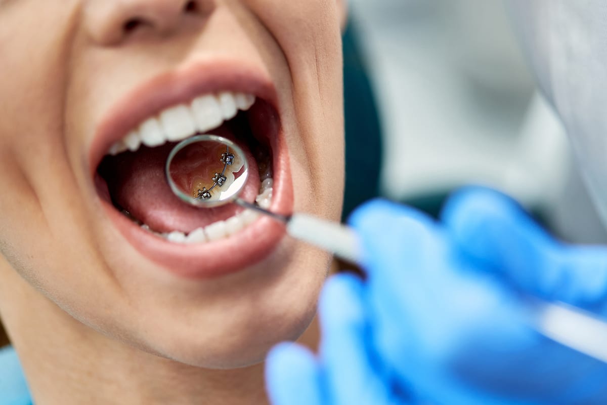 The BRIUS Technique | Maplewood, NJ | Marigold